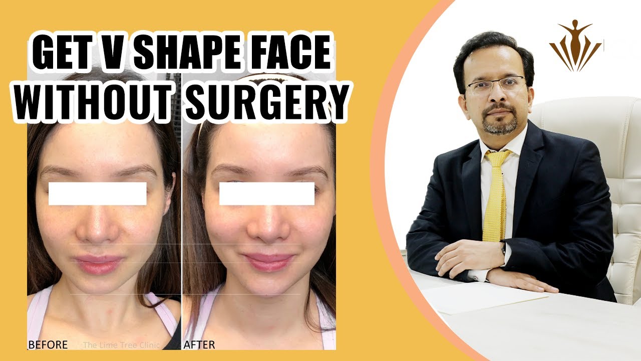 How to Get V Shape Face with Botox? | Face Slimming without Surgery - YouTube