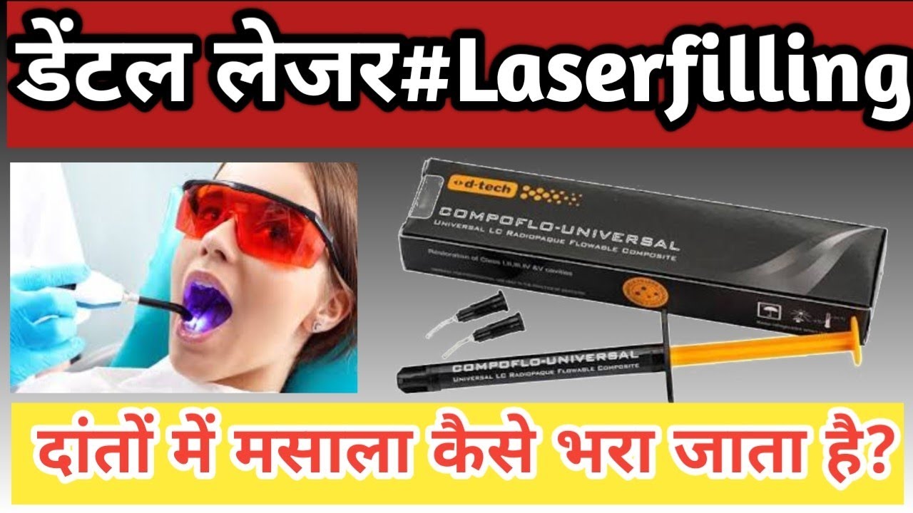 "Dental Laser Filling क्या है? दाँतों में मसाला ऐसे भरा जाता है | Laser ...