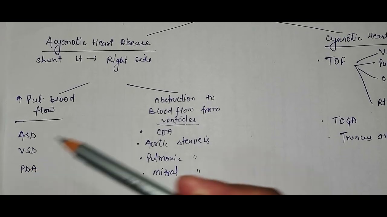 Classification of congenital heart disease/CHD/acyanotic heart disease ...