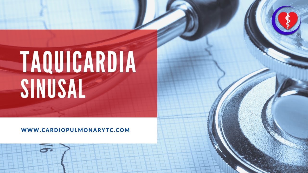 Taquicardia Sinusal - YouTube