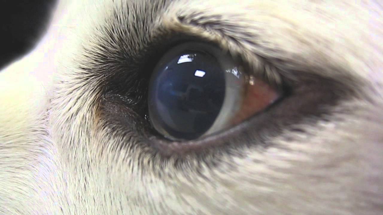 Iridodonesis and Phacodonesis - YouTube