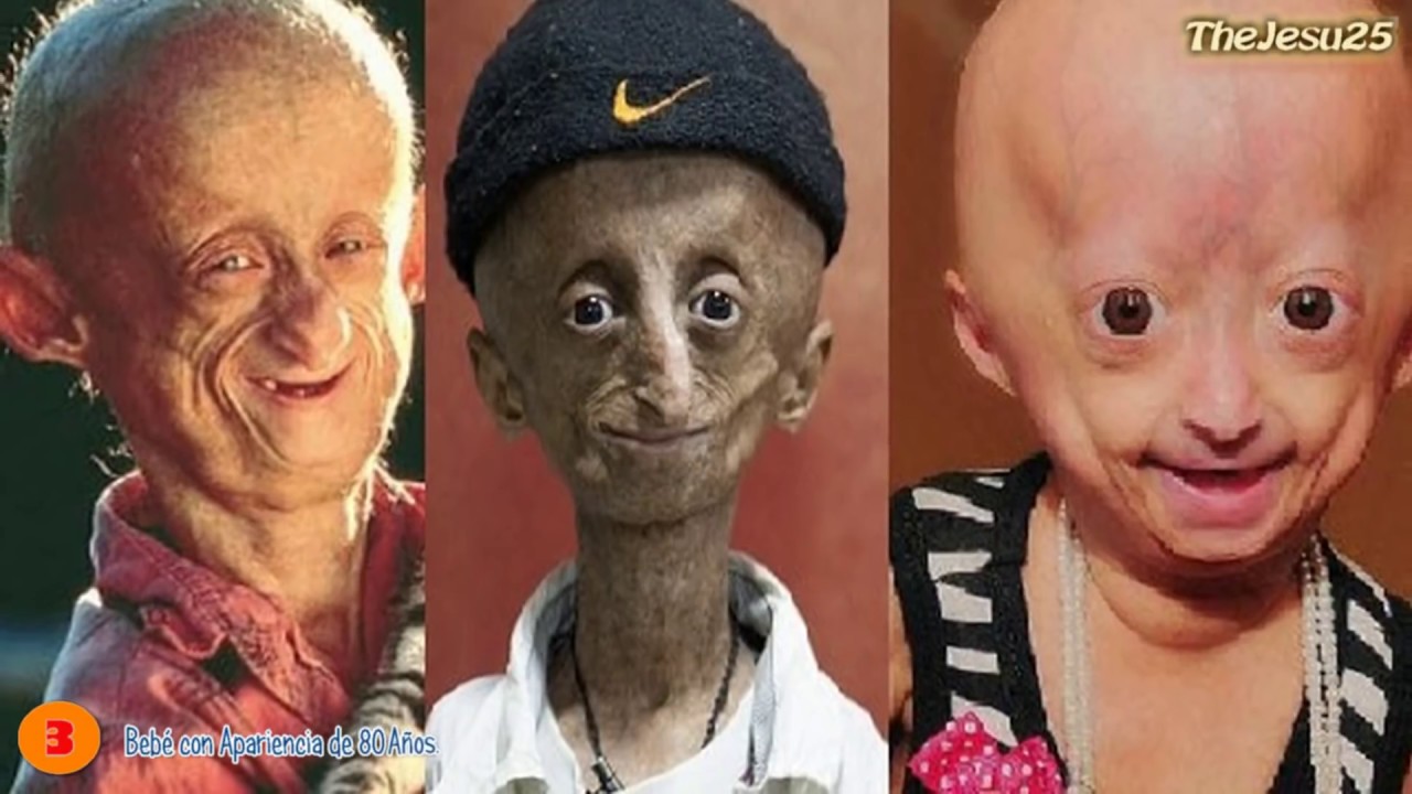 Nacimientos de Bebés Humanos Mas Raros Del Mundo! - YouTube