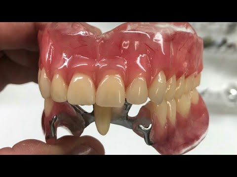 Acrilizando uma PPR - YouTube