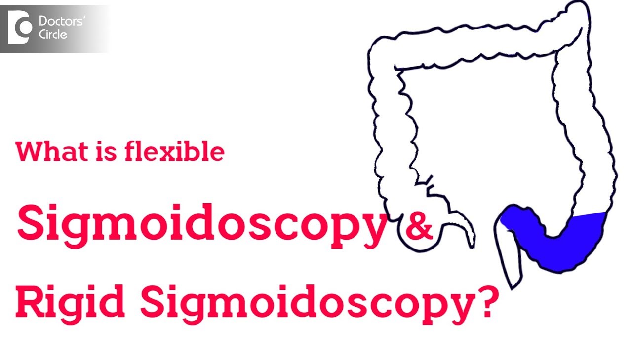 Sigmoidoscopy