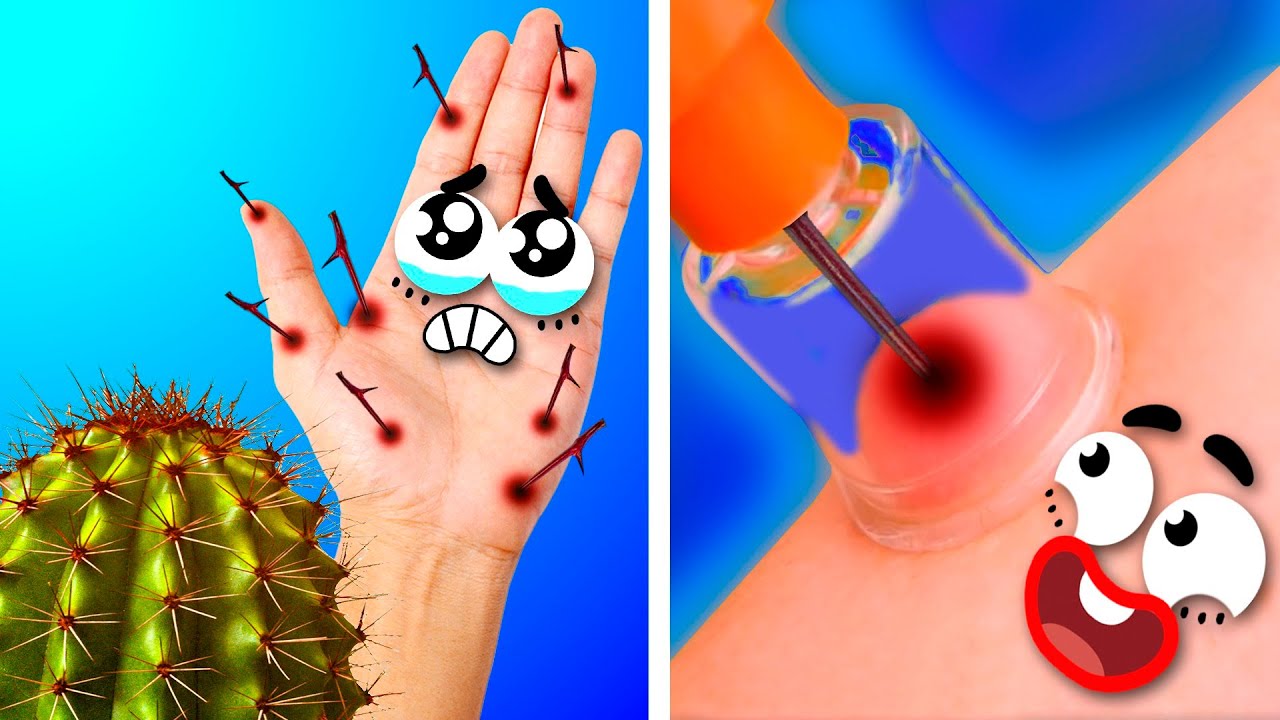 OUCH! Crazy Situations From The Life Of Doodles || Embarrassing Moments ...