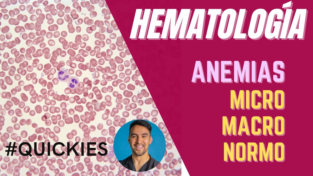 ANEMIAS normocíticas, macrocíticas y microcítica.- un resumen práctico ...