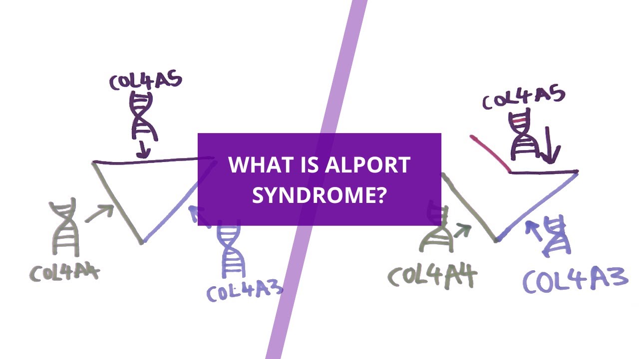 Alport Syndrome Symptoms Children