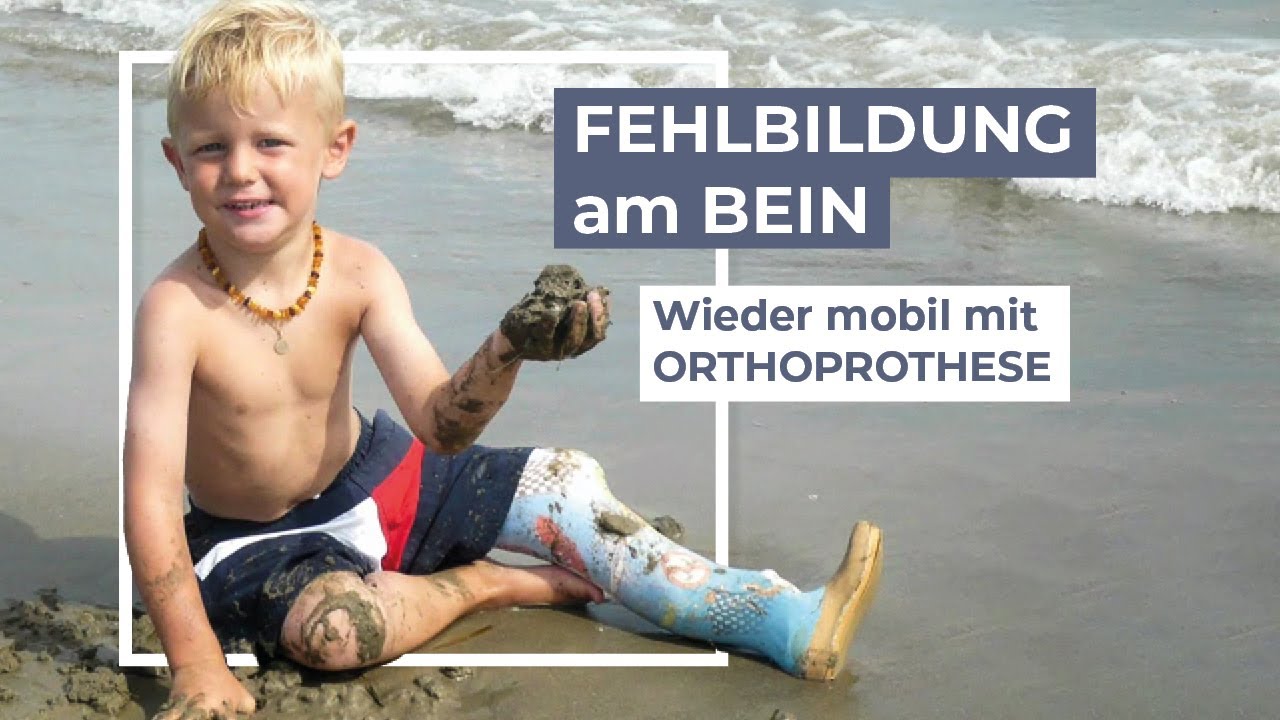 Dysmelie/angeborene Fehlbildung | Versorgung mit Orthoprothesen - YouTube