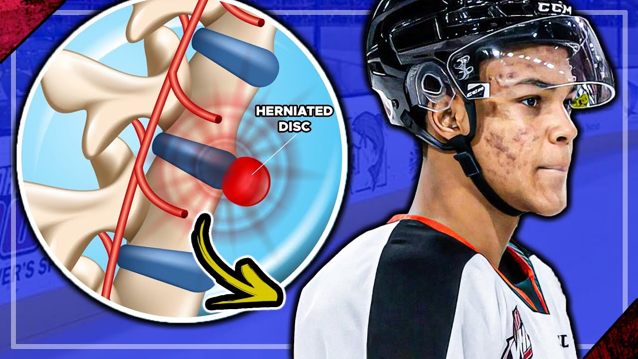 This is NOT good... - Truth REVEALED behind Cayden Lindstrom's injury ...