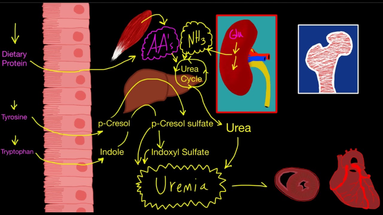CKD: Uremia and dietary protein - YouTube