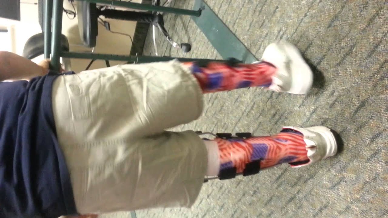 Walking With Kafo And Shoe Lift Youtube