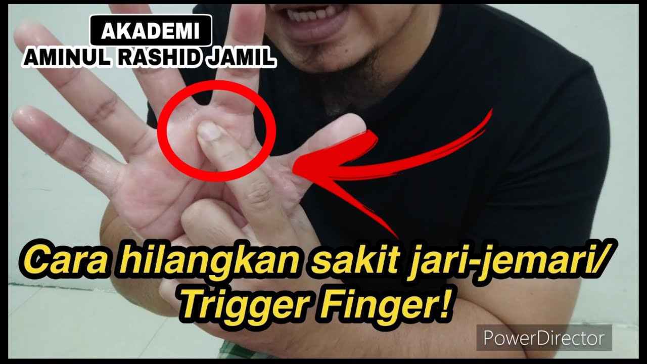 Cara mujarab urut Trigger Finger/ sakit jari-jemari/ jari sangkut ...