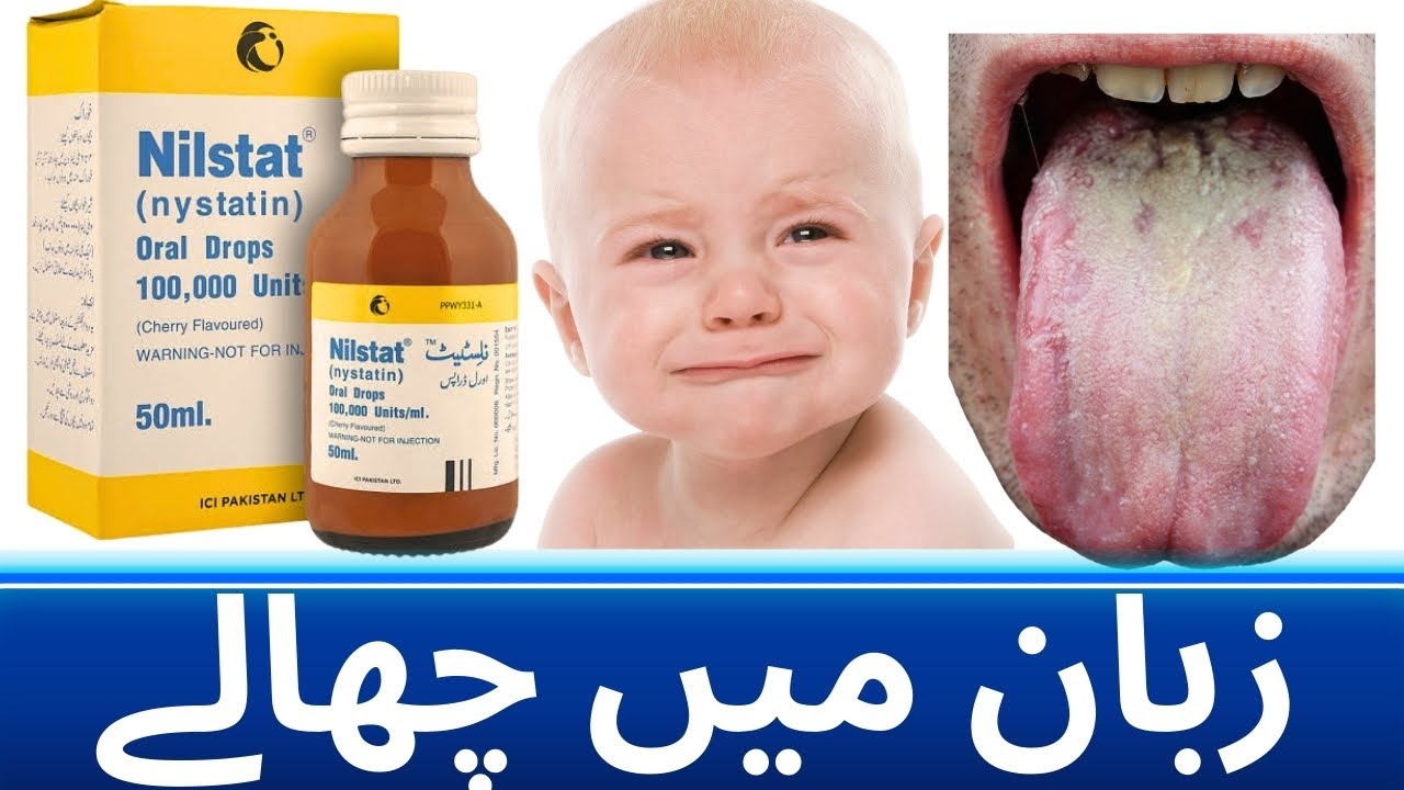 nilstat drops uses for babies || nystatin uses in hindi || nilstat ...