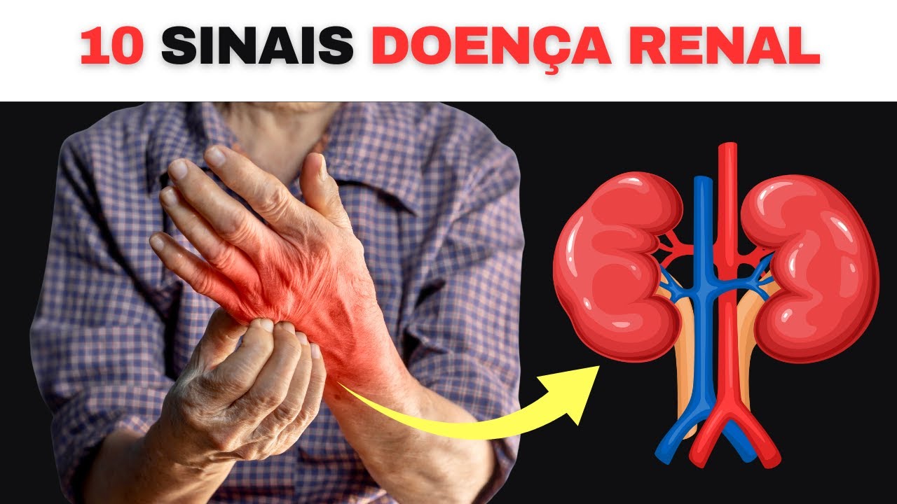 Descubra 10 SINAIS que Podem Indicar PROBLEMAS RENAIS - YouTube