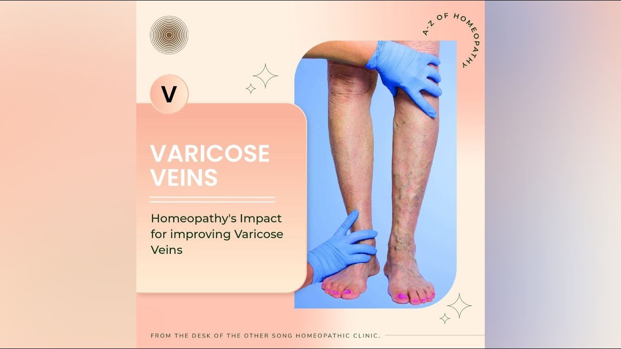 Letter V - Varicose Veins - YouTube