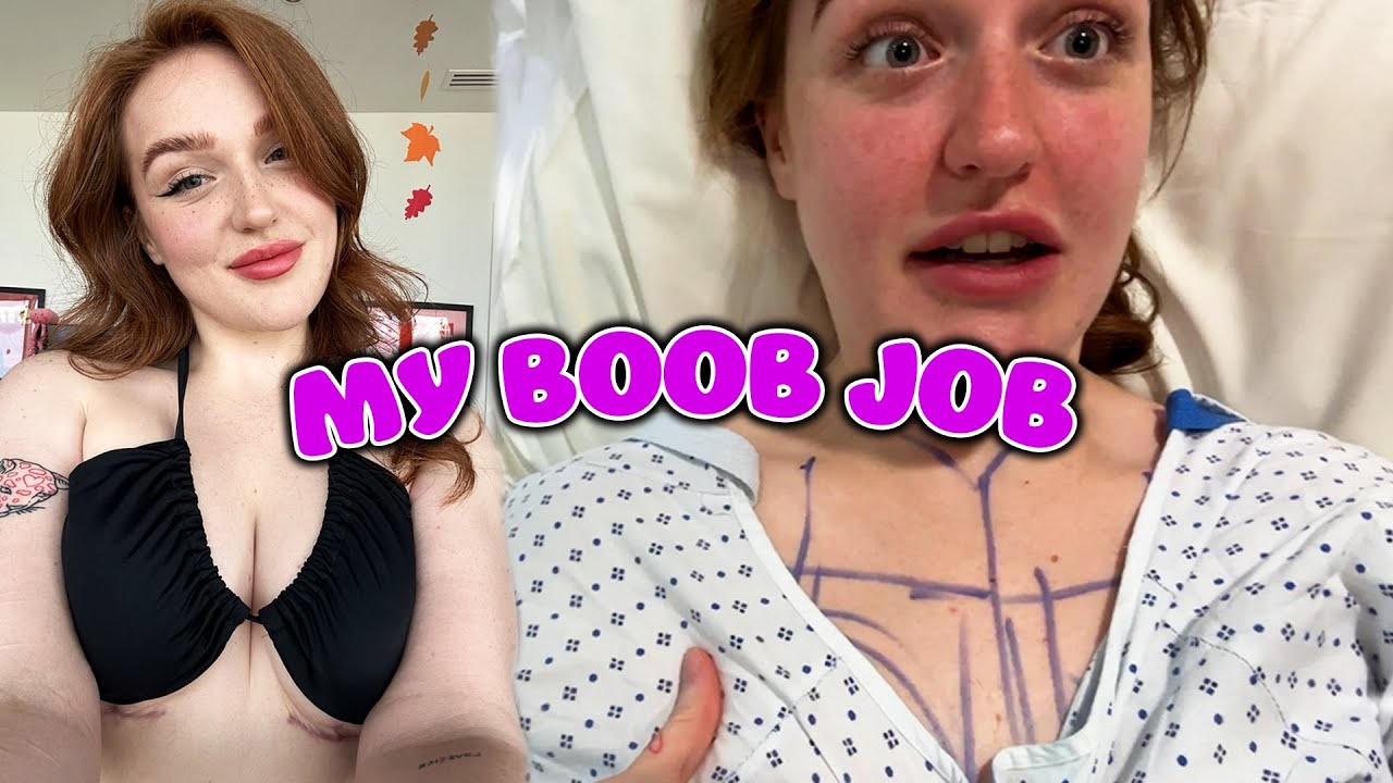 My Boob Job Vlog Surgery Recovery And Results Youtube