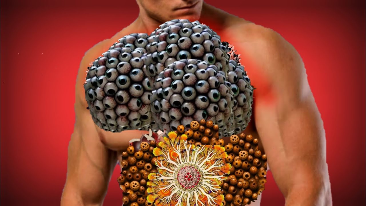 ASMR removal and 2d animation treatment/infected body treatment video ...