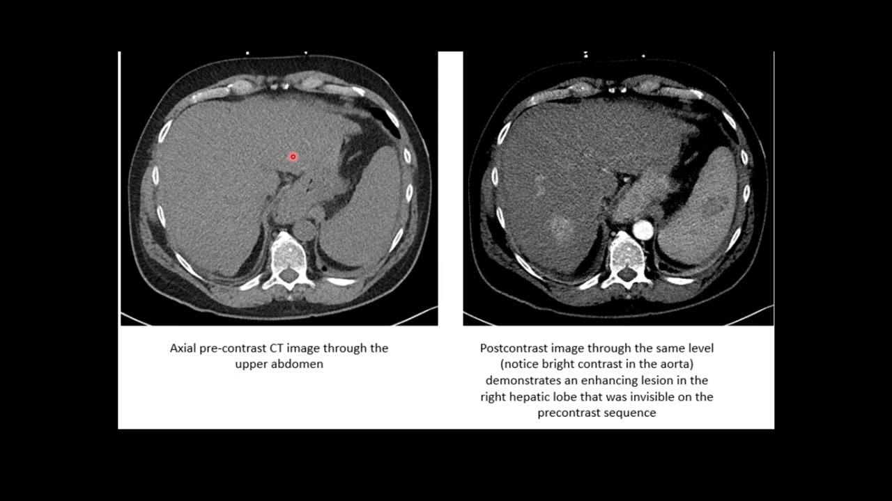 Contrast agents in radiology - YouTube