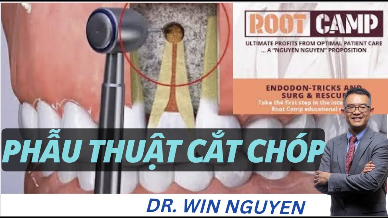 Sự Khải Hoàn Của Phẫu thuật Cắt Chóp | Dr. Win Nguyen - YouTube