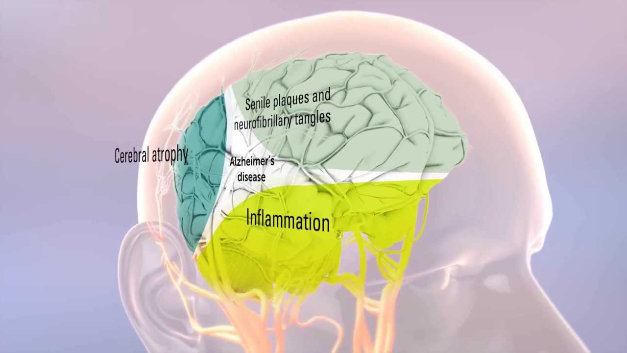 Axona DCGM Animation - YouTube