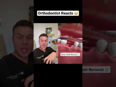 How Replace Your Rotten Teeth