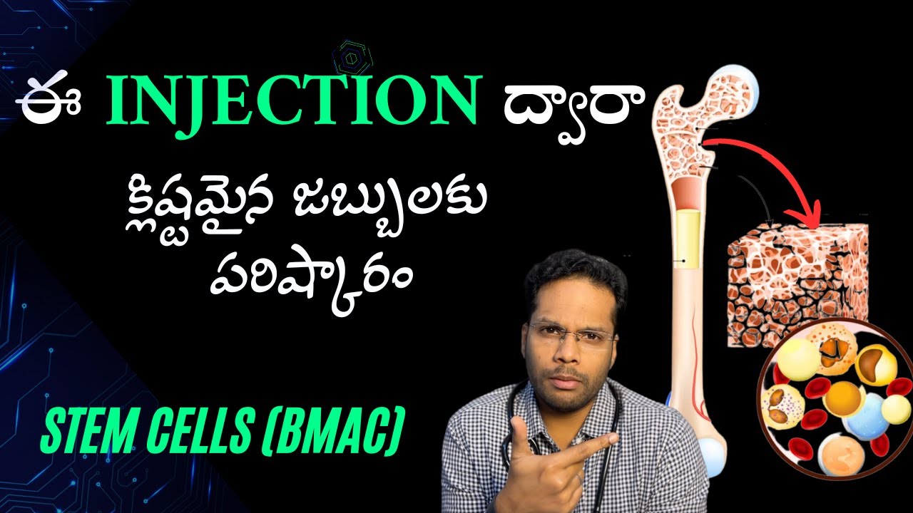 Stem cell therapy (BMAC) | Bone marrow aspirate concentrate for ...