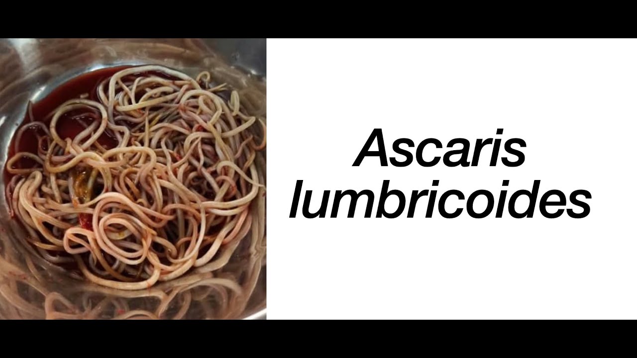 Ascaris lumbricoides: Ciclo de vida, Síntomas y Tratamiento ...
