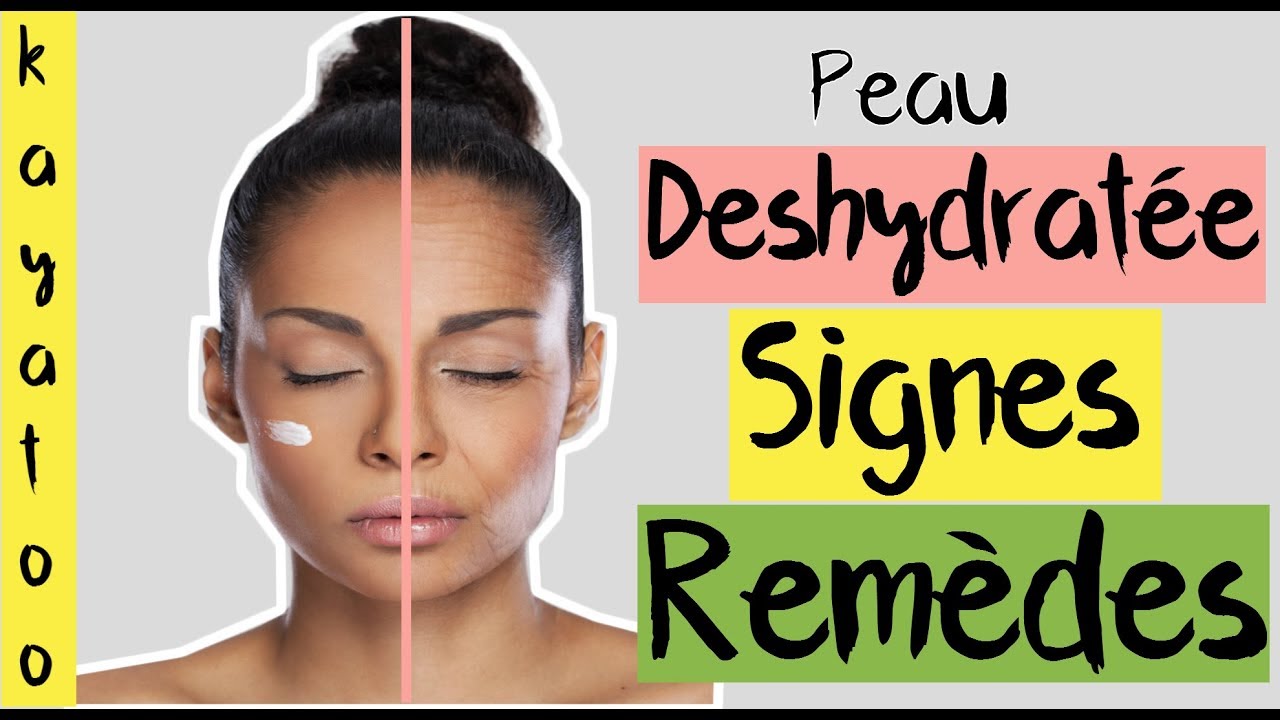LA PEAU DESHYDRATEE SIGNES ET REMEDES | KAYATOO - YouTube