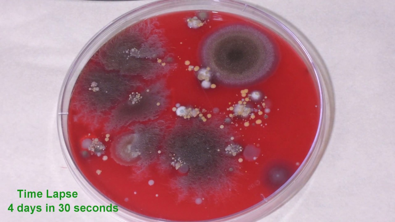 Handwash Time Lapse bacteria - YouTube