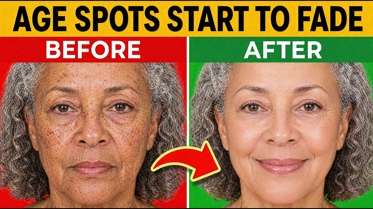 Fix Your Age Spots Over 60! These Incredible Skin Secrets Revealed ...