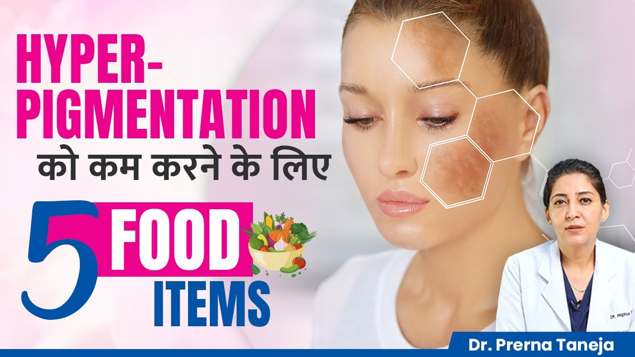 Hyperpigmentation को कम करने के लिए 5 Food Items |5 Foods to Reduce ...