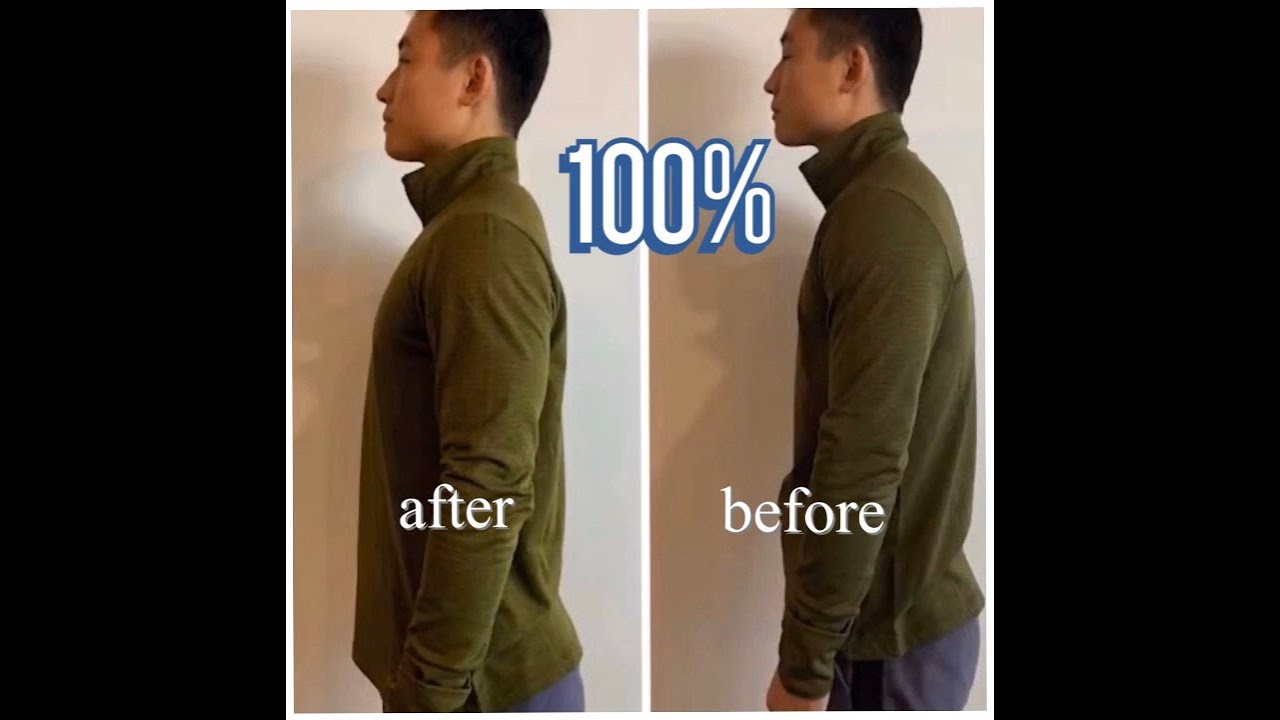 how to fix hunchback posture.Effective training exercise有效改正驼背，背部训练 ...