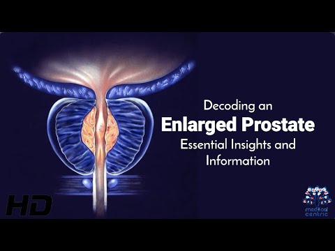 Enlarged Prostate Explained: Symptoms, Causes, and Treatments - YouTube