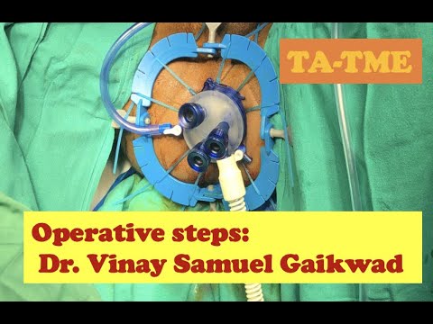 Transanal Total Mesorectal Excision (TA-TME) | Dr. Vinay Samuel Gaikwad ...