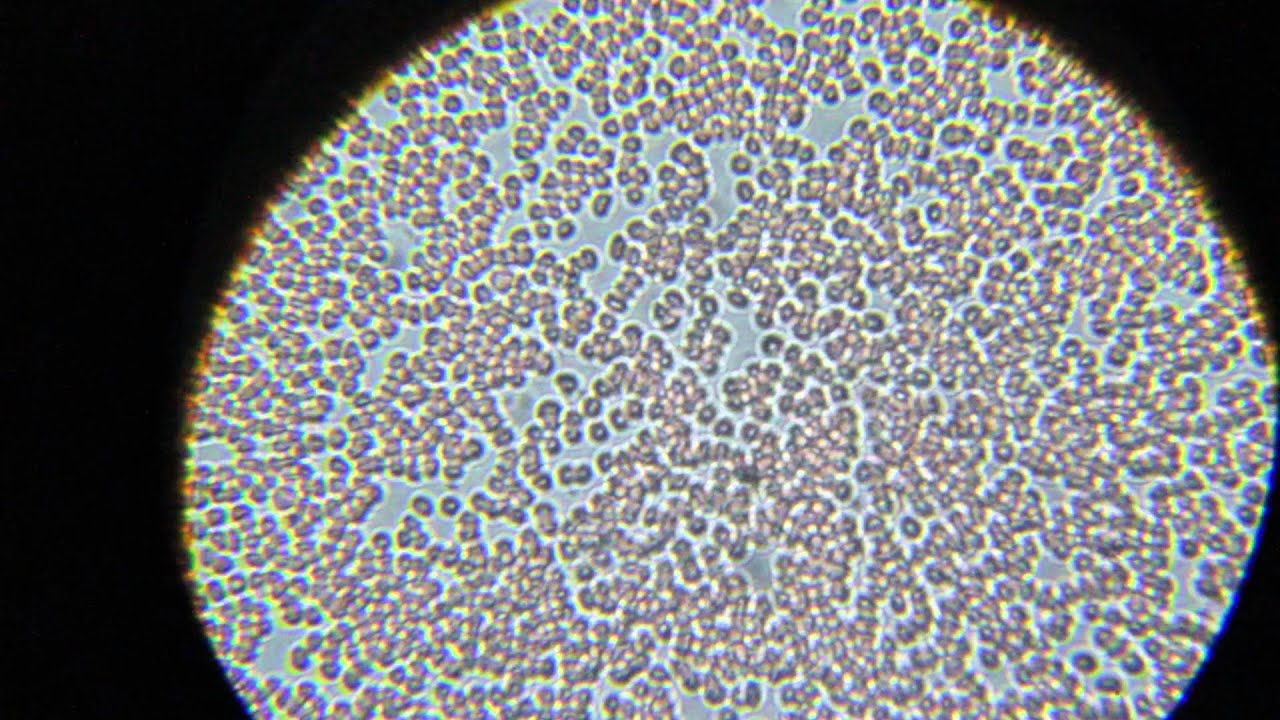 Human Blood Sample_Blue Stain - YouTube