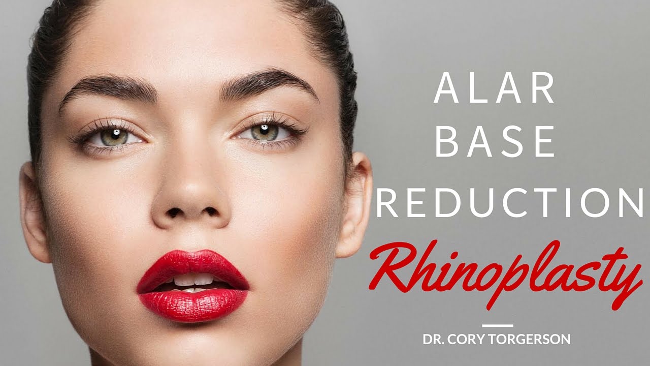 Alar Base Reduction Rhinoplasty | Dr. Cory Torgerson - YouTube