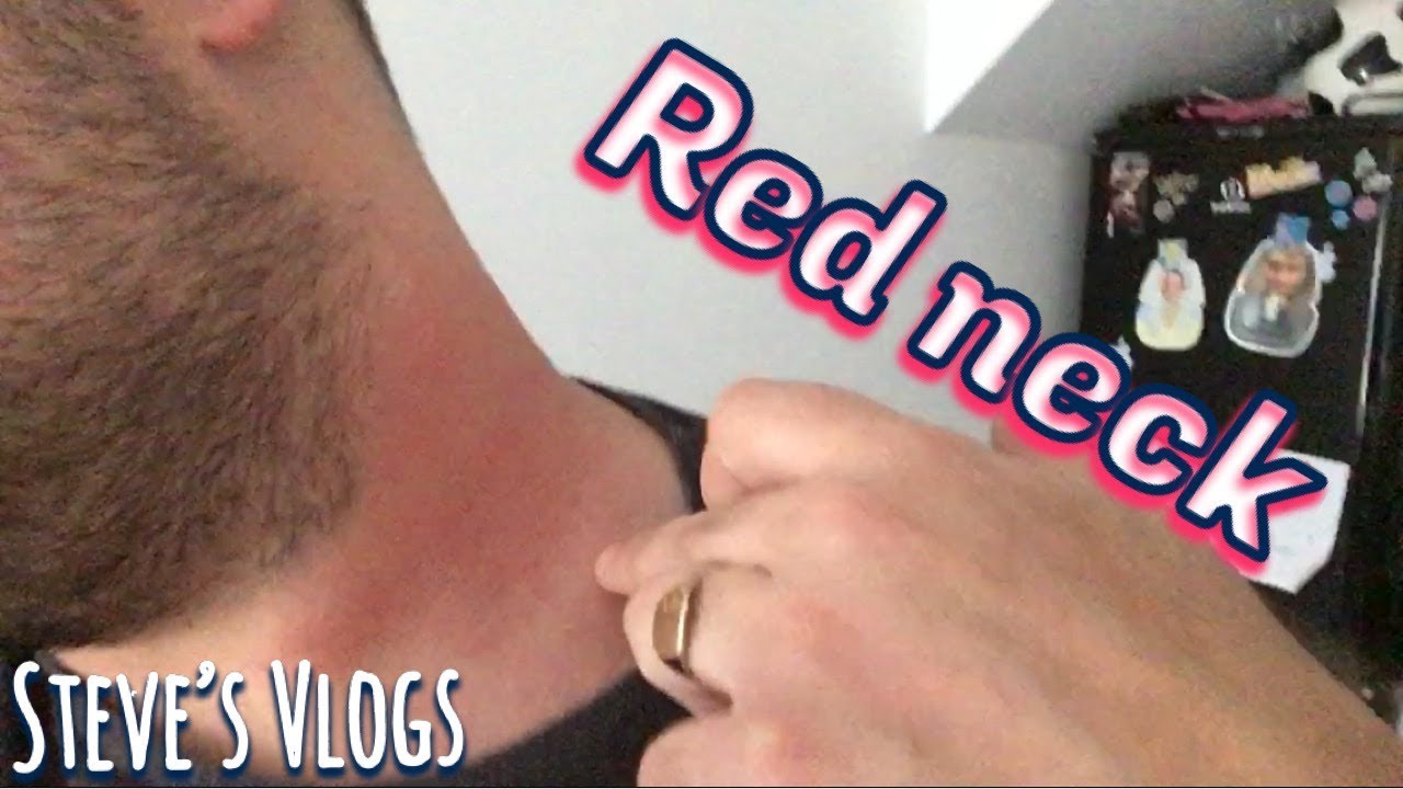 Red Neck | Daily Vlog | #stevesvlogs - YouTube