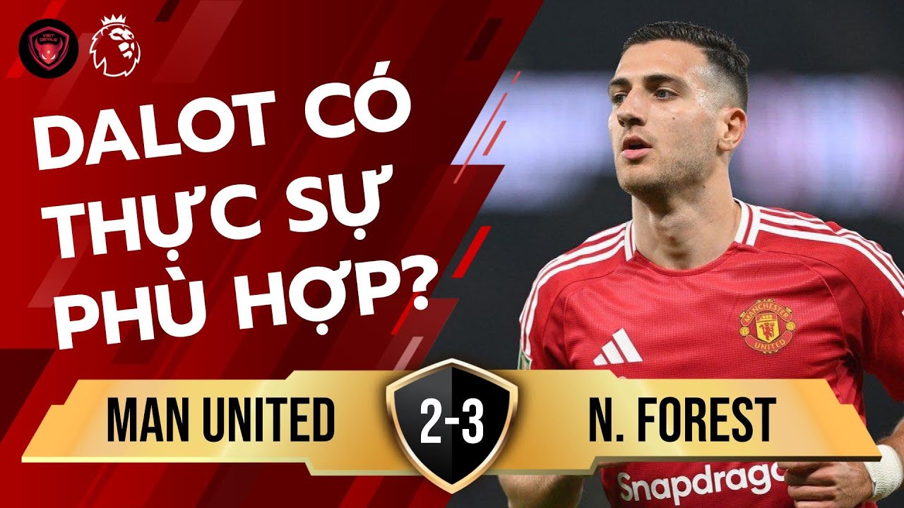 🤬😡 DALOT?! MU Thua Sập Mặt! ft. Hieu-ck RAY | Man United 2 - 3 Forest ...