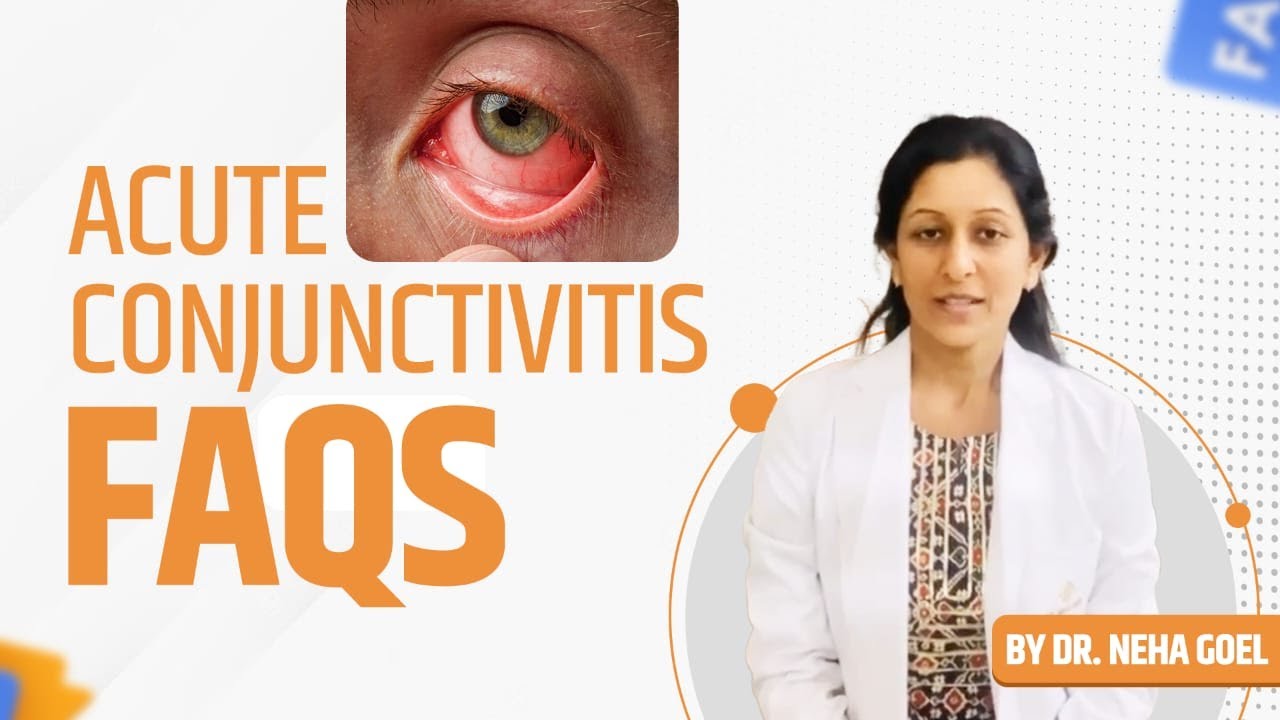 Conjunctivitis I pink eye I meaning I types I causes I precautions I ...