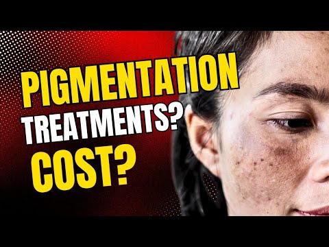 Common Pigmentation Questions Answered | Treatments, Procedures & Cost ...
