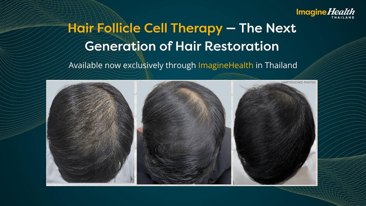 Hair Follicle Cell Therapy: Regrow Your Hair with Advanced Cellular ...