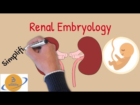 Kidney Embryology/Congenital Defects, part 1, Simplified for USMLE ...