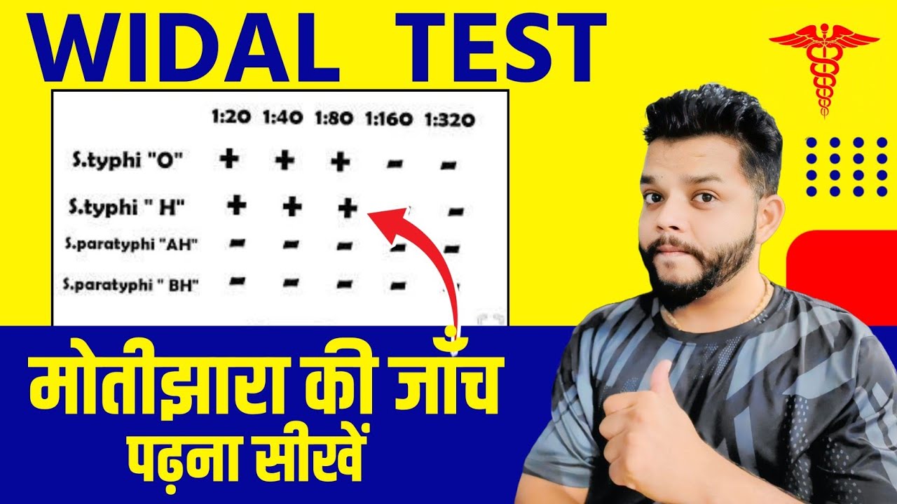 Widal Test कैसे समझे | How To Read Widal Test Report | Typhoid Blood ...
