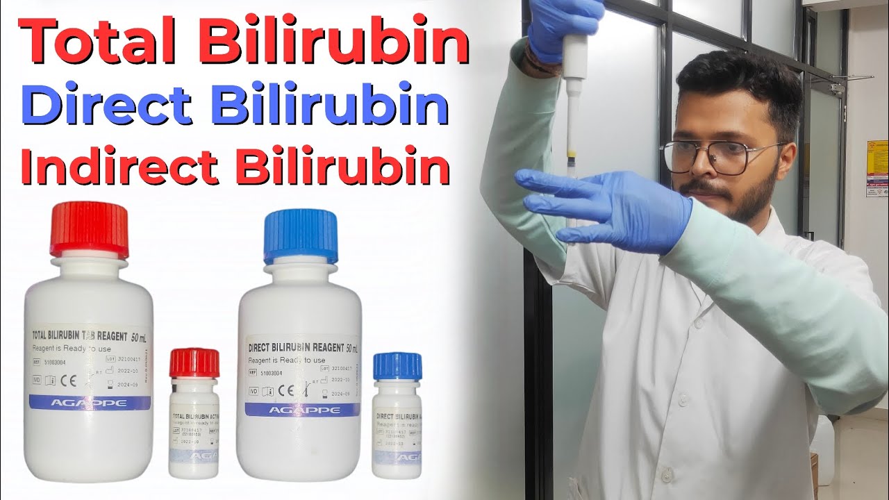 Total bilirubin test procedure | Direct bilirubin test procedure ...
