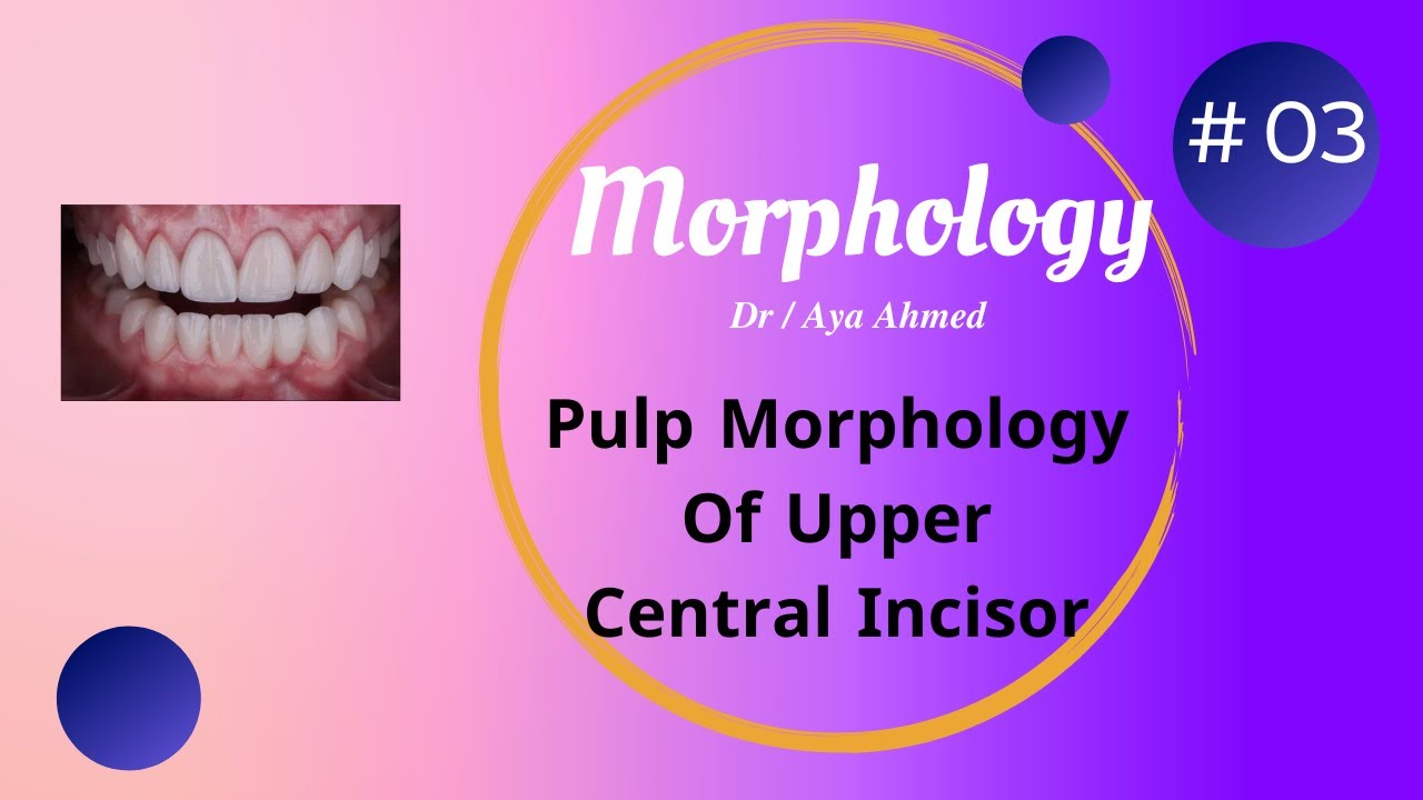 Morphology - #03 - Pulp Morphology Of Upper Central Incisor - YouTube
