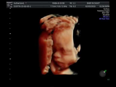 HD Live ultrasound at 24 weeks (baby #6 Ju'Shai) - YouTube
