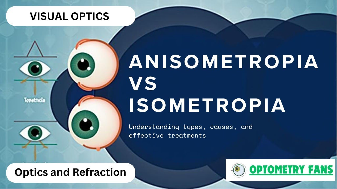 Anisometropia | What is anisometropia | Isometropia | Type, Causes ...