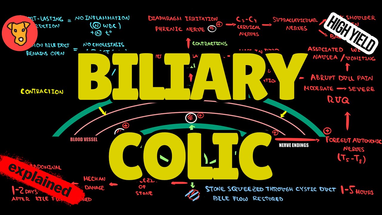 Biliary Colic EXPLAINED: Pathogenesis, Symptoms & Treatment (USMLE High ...