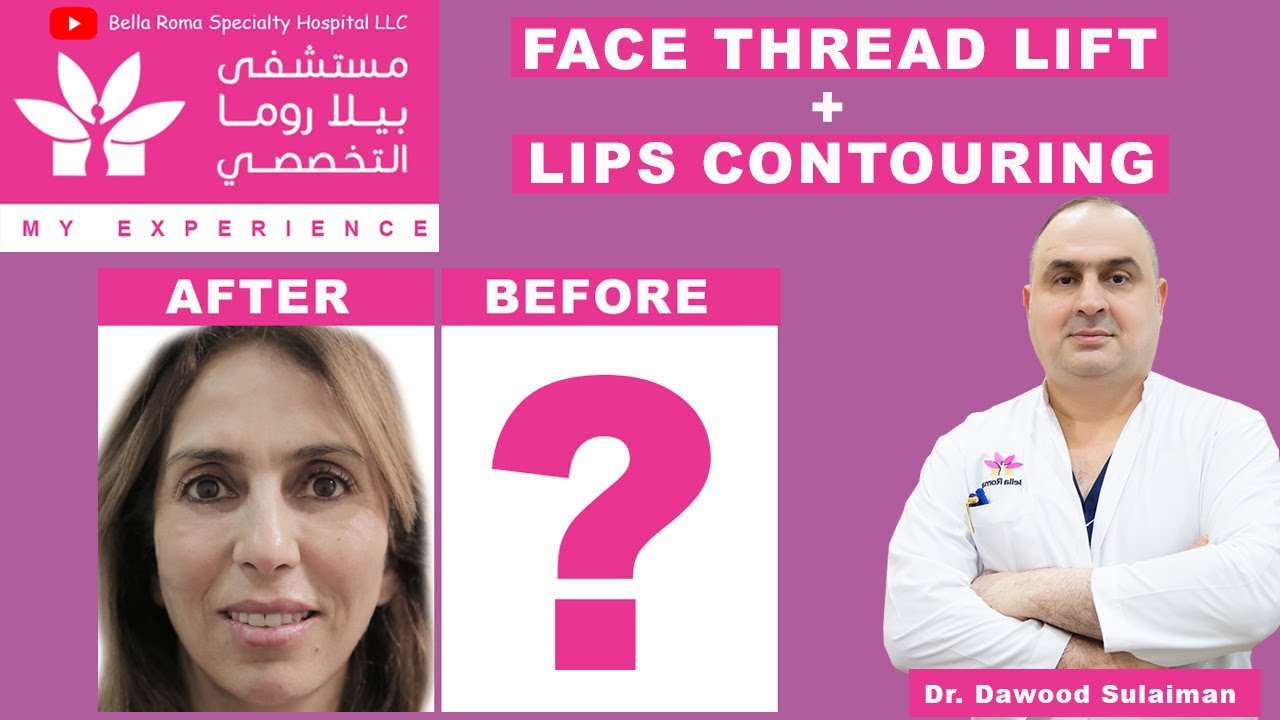 Face Thread Lifting + Lips Contouring in Bella Roma Hospital - YouTube