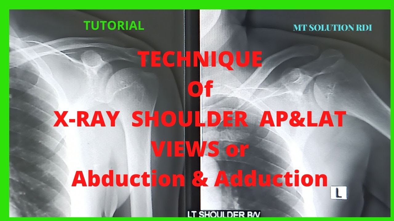 X Ray Humerus AP And Humerus Lateral View — ETECH By, 58% OFF